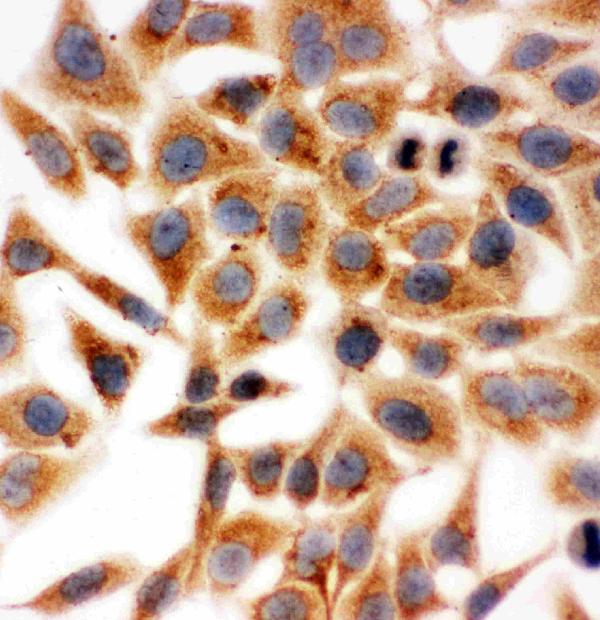 HSD17B1 Antibody PA1613-1