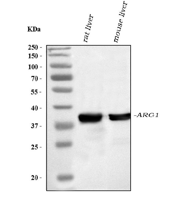 Anti-liver Arginase/ARG1 Antibody PA1783