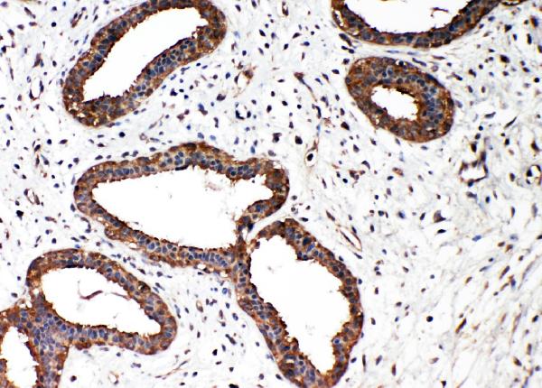 Anti-Smad2 Antibody PA1898