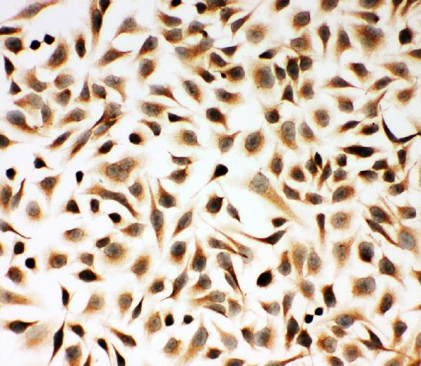 Anti-Smad2 Antibody PA1898