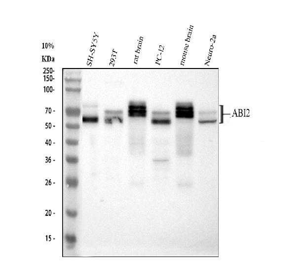 Anti-ABI2/Abl interactor 2 Antibody (PA2068) | Bosterbio