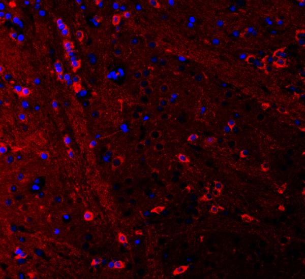 Anti-PSD95/DLG4 Antibody