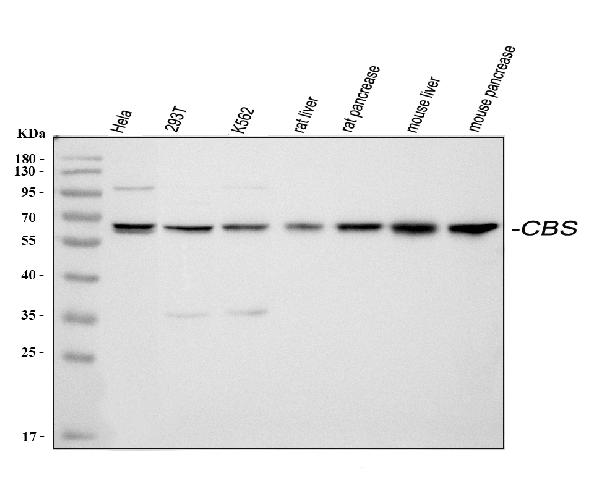CBS/Cystathionine beta-synthase Antibody