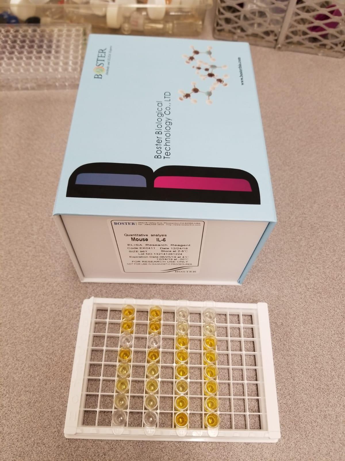 Mouse IL-6/Interleukin-6 ELISA Kit Price PicoKine® | BosterBio